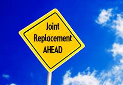 Reasons You Need Total Joint Replacement - McLeod Health