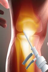 Arthroscopy - Most Common Ortho Procedure - McLeod Health