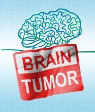 Brain Cancer Overview. What you Need to Know. - McLeod Health