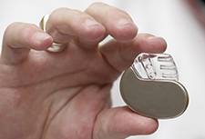 The IMPLANTABLES: Super Help for Erratic Hearts - McLeod Health