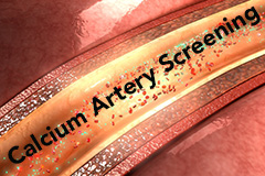 Calcium Artery Screening for Earlier Heart Help - McLeod Health