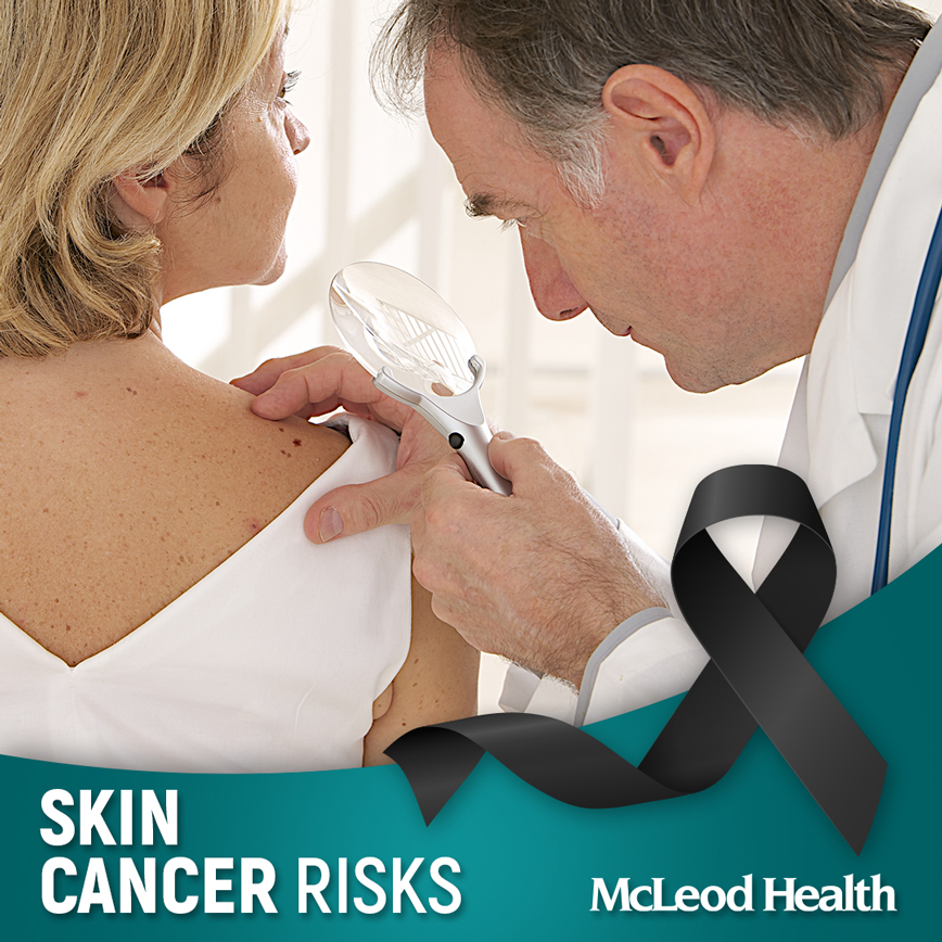 Detecting Skin Cancer Early - McLeod Health