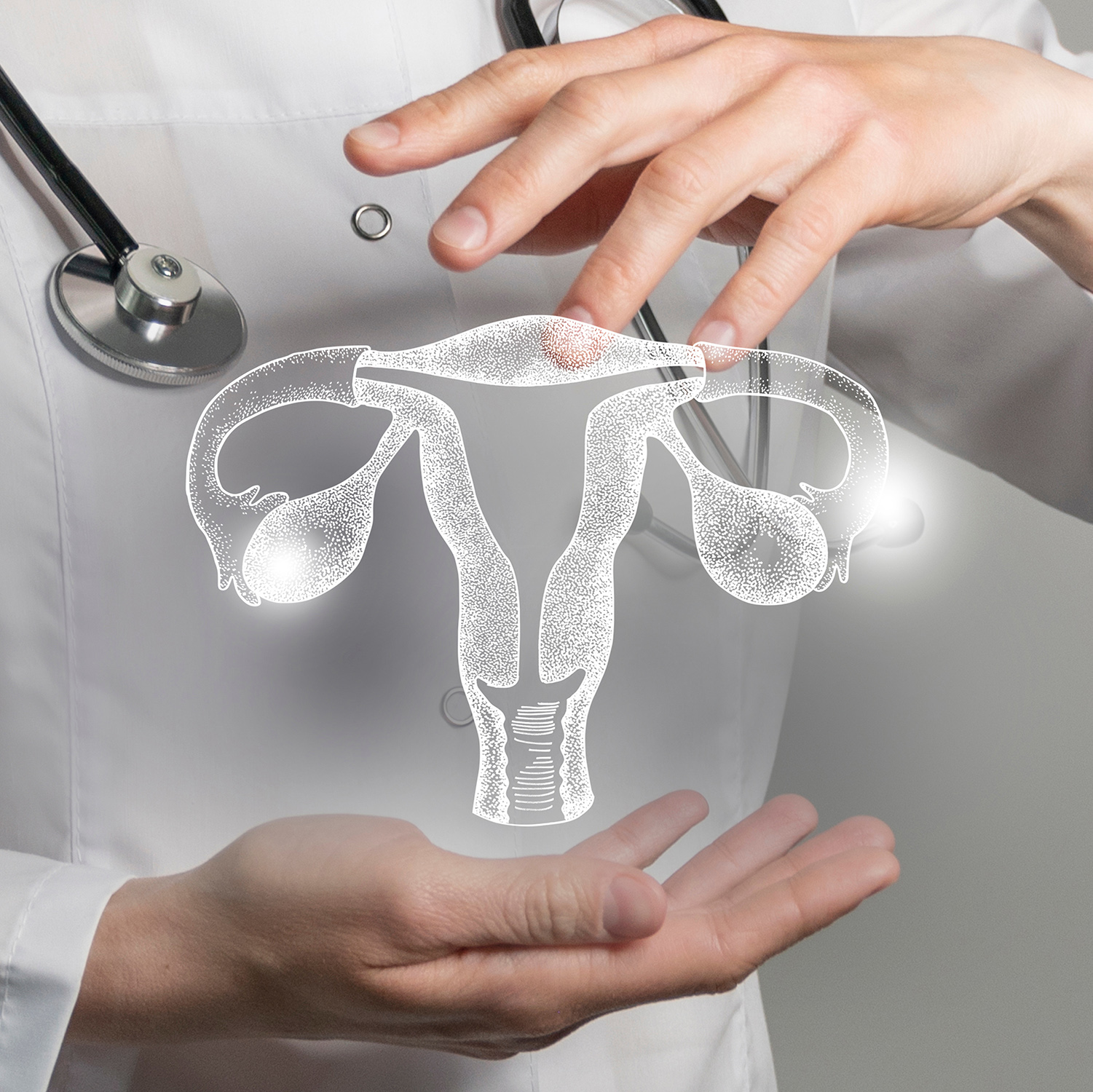 Primary Ovarian Insufficiency - When a Younger Woman's Follicles Fail ...