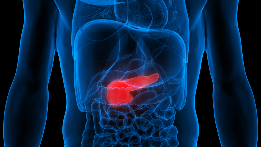 Advancements in Pancreatic Cancer Surgery: The Whipple Procedure ...