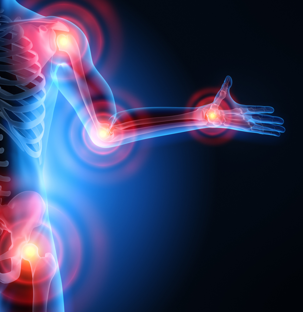 The 5 Most Common Orthopedic Surgeries - McLeod Health