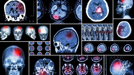Neurology — McLeod Health